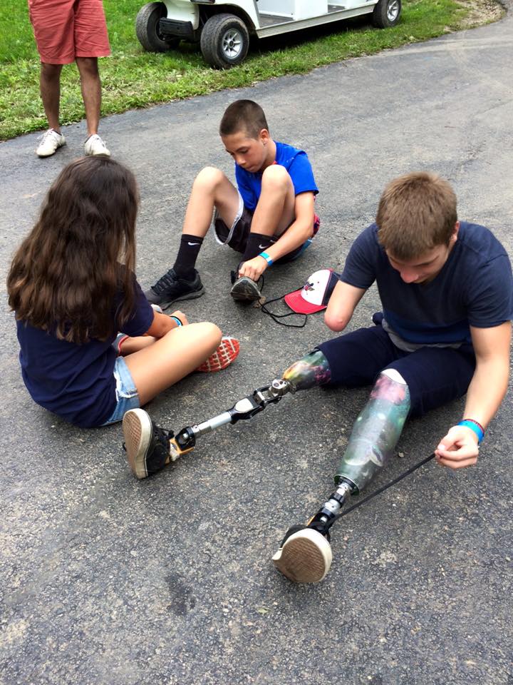 10 Reasons why Being an Amputee is the Best | Lacey Henderson